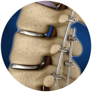Failed Back Syndrome in NJ & NY | Advanced Spine Center