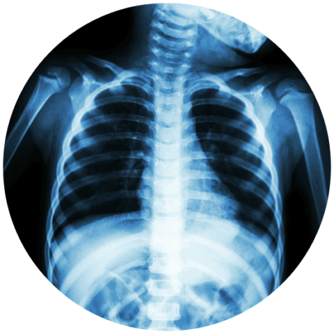 Pediatric Spine | Symptoms & Advanced Spine Care
