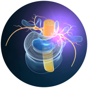 Radiculopathy Symptoms & Treatment Options | Advanced Spine