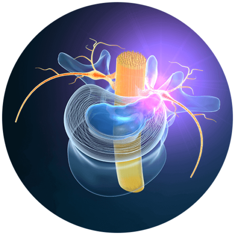 Radiculopathy Symptoms & Treatment Options | Advanced Spine