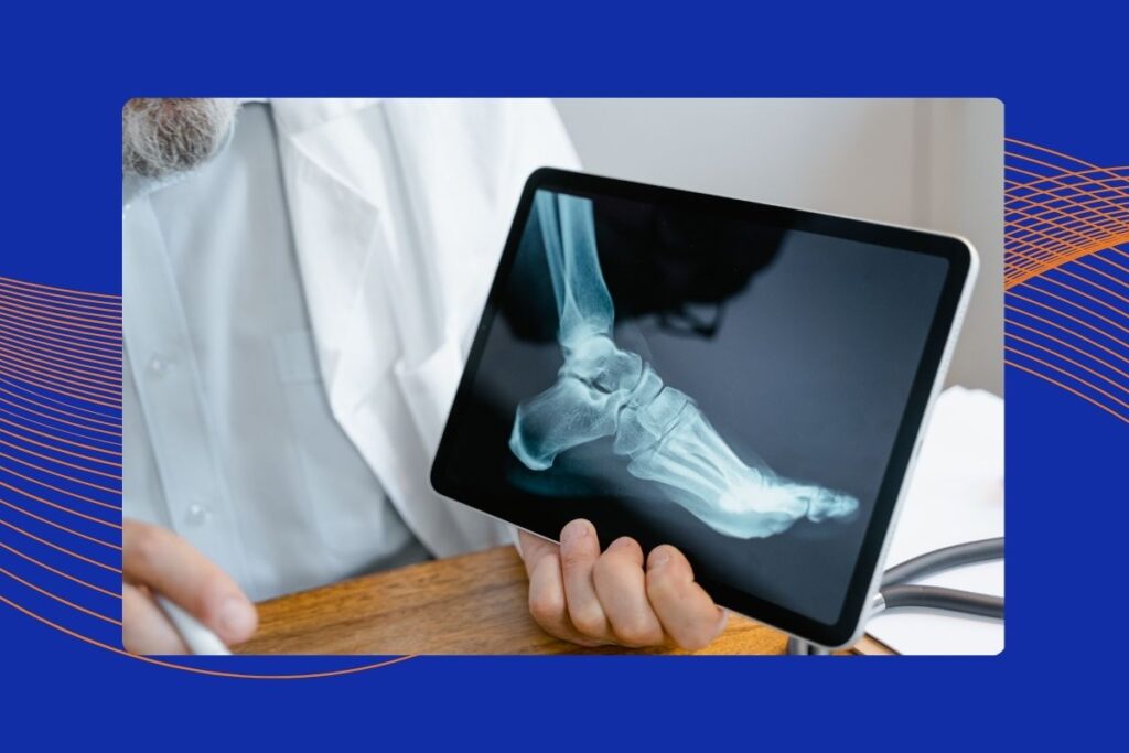 6 Bone Diseases That You Should Know | Advanced Spine Care